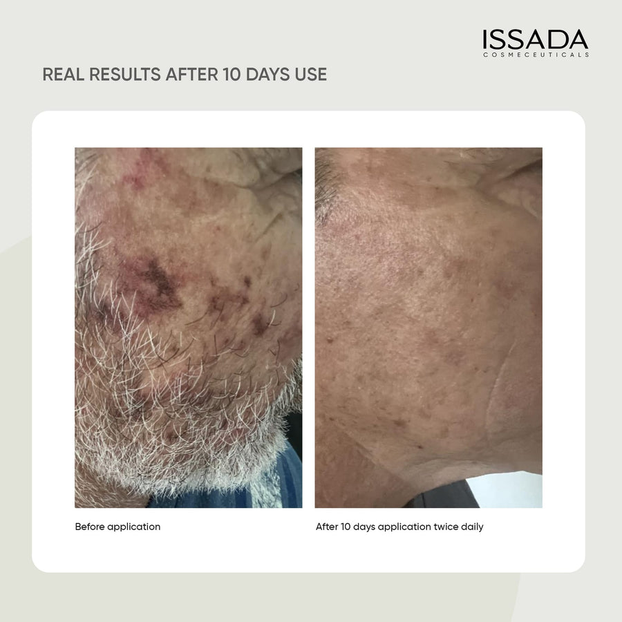 Synbiotic Moisturiser – ISSADA Cosmeceuticals